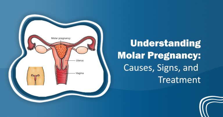 What Is Molar Pregnancy? Signs, Causes & Management