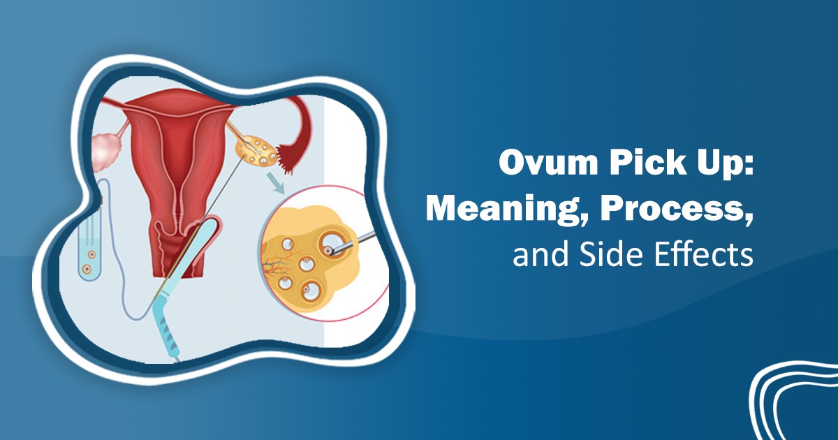 Ovum Pick Up Procedure: What It Is & How to Prepare